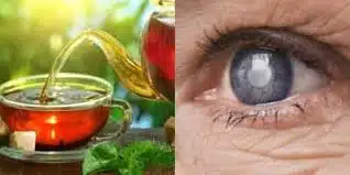 The Benefits of Teas for Eye Health